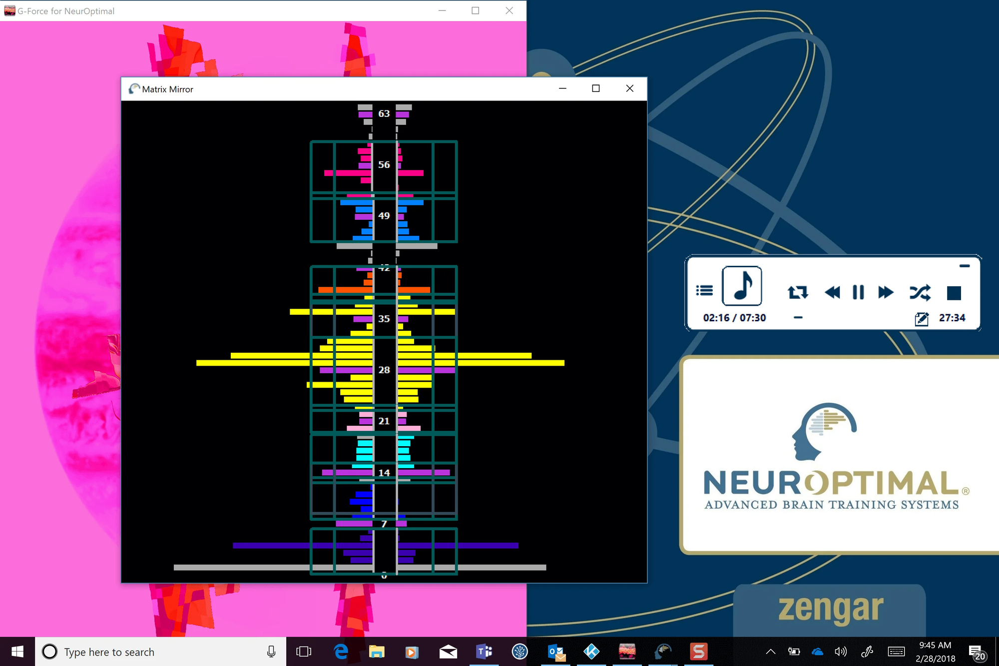 Neurofeedback | Buy Your Own Machine