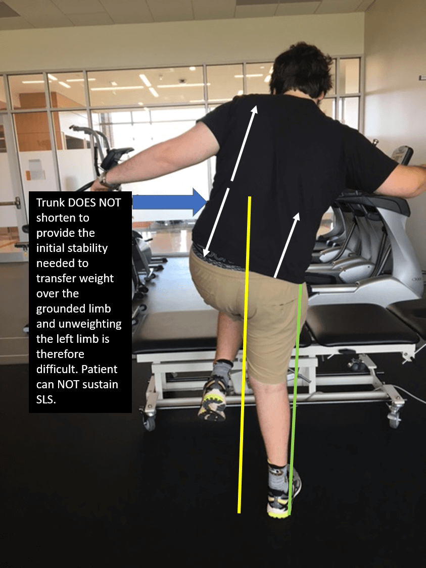 Transitioning to SLS - Movement Solutions for PT