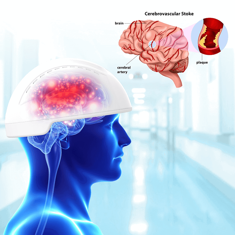 Photon Bio-Modulation (PBM) Laser Helmet - Biostar Technology ...