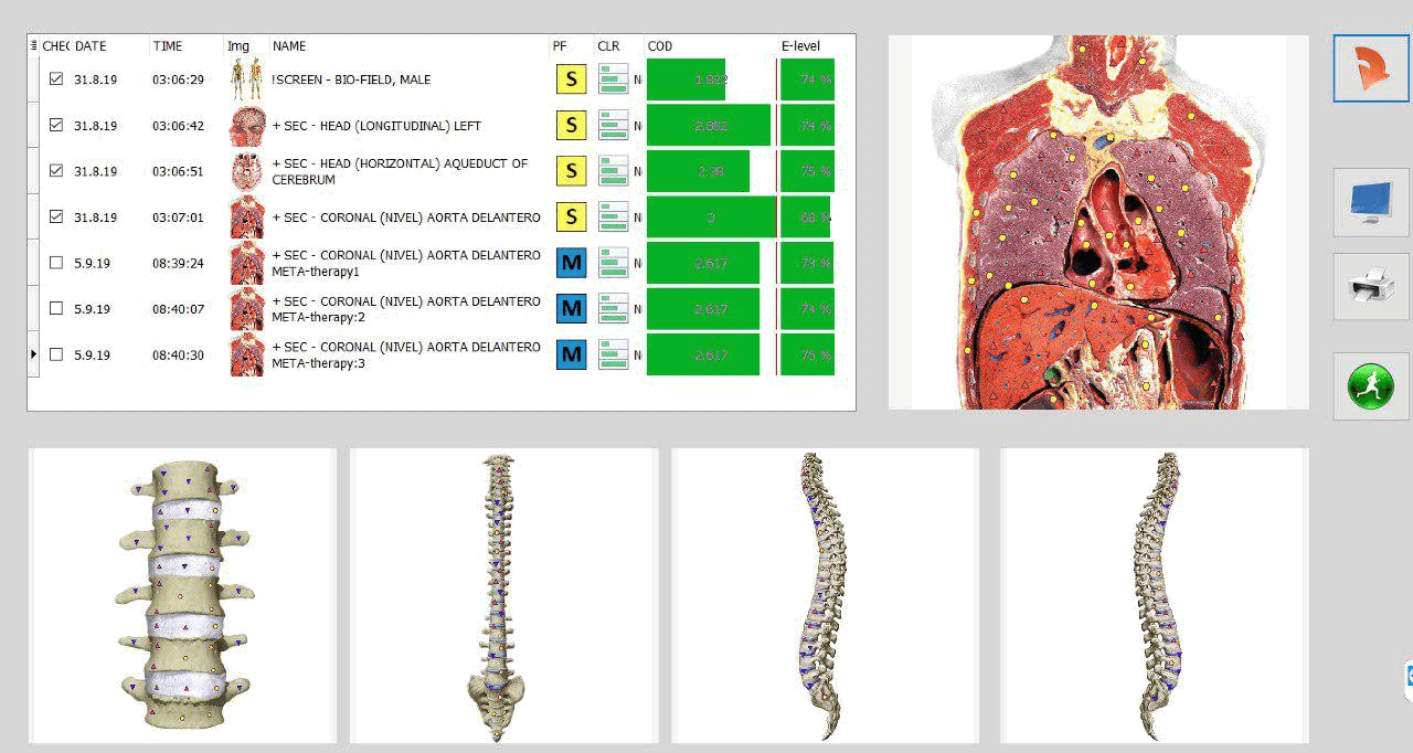 Vector™ XP 2020 - Biostar Technology International - Germany