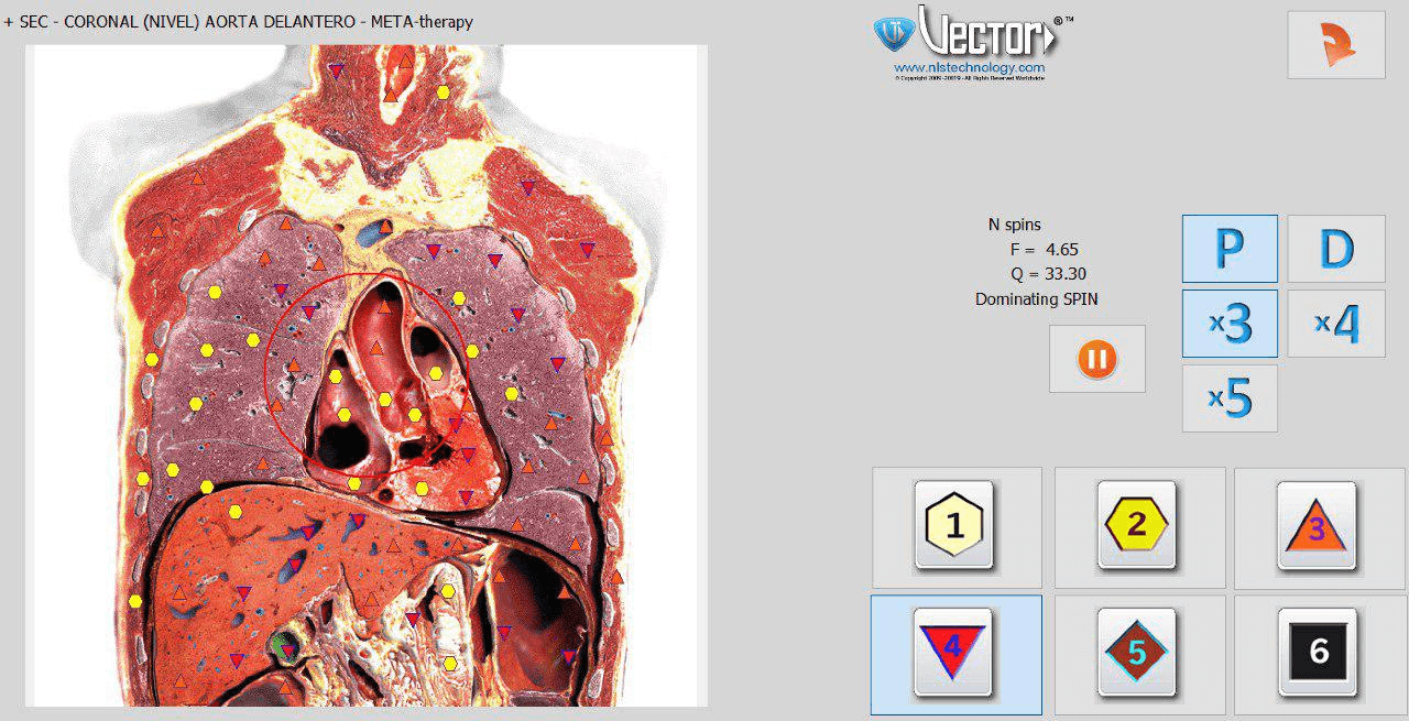 Vector™ XP 2020 - Biostar Technology International - Germany