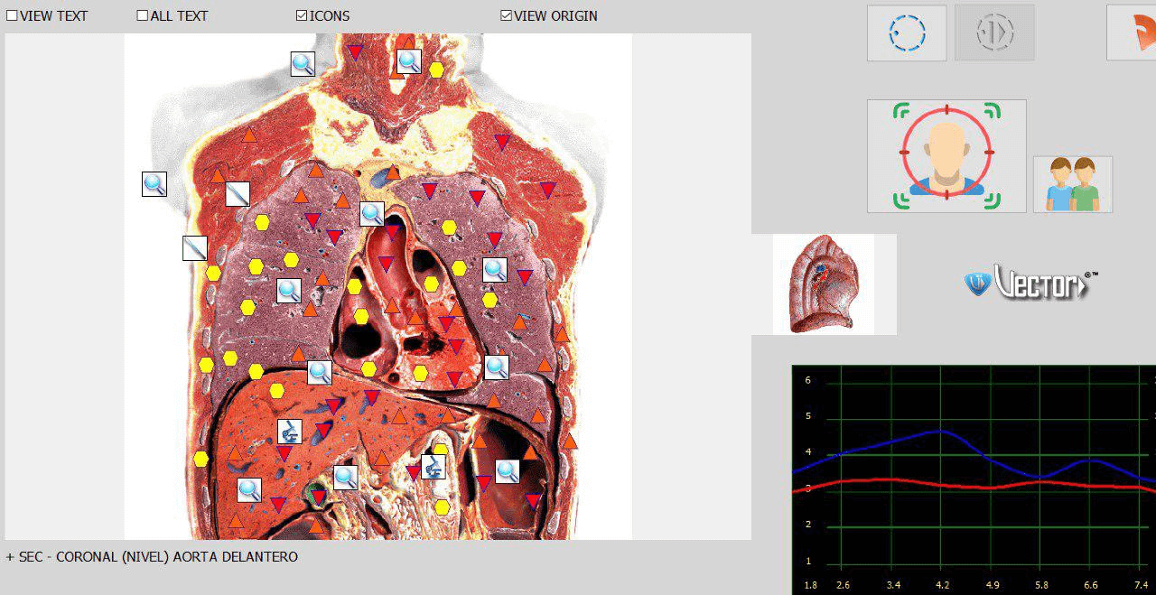 Vector™ XP 2020 - Biostar Technology International - Germany