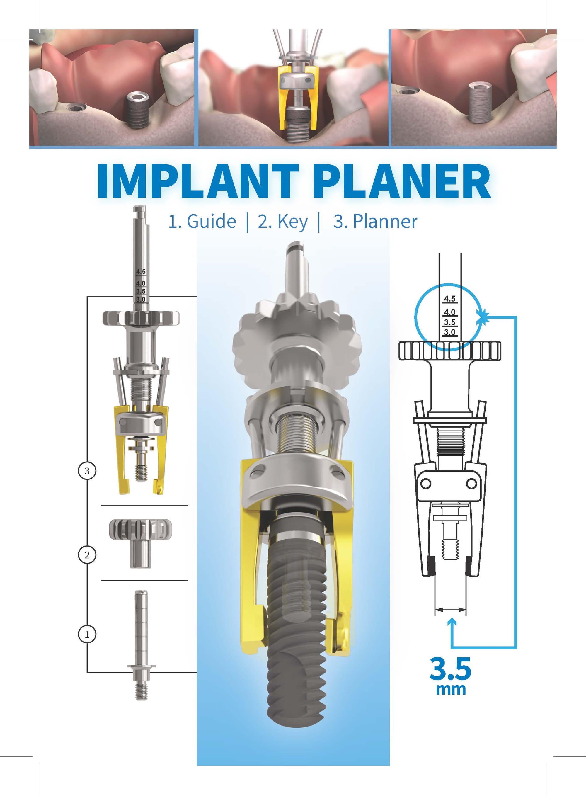 INSTRUCTION FOR USE "iMPACT" - IMPACT Predictable Peri-Implantitis ...